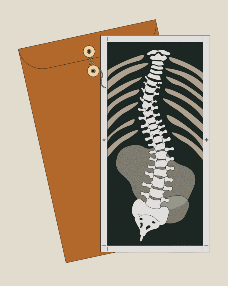 scan findings – oh my back